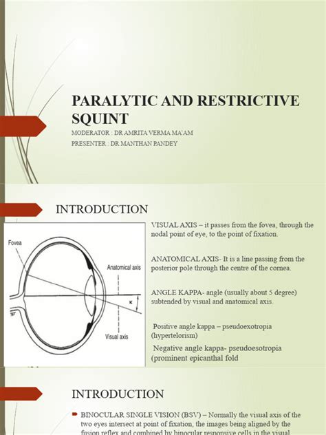 Paralytic And Restrictive Squint Pdf Senses Eye