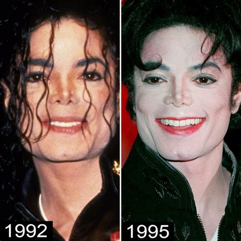 Michael Jacksons Plastic Surgery — See His Transformation Life And Style