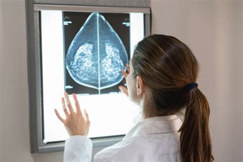 Deep Learning Model As Accurate As Radiologists In Identifying Breast Density Health Data
