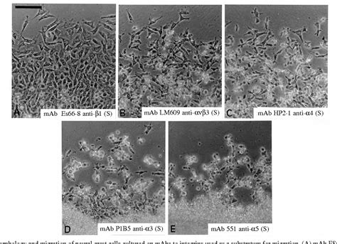 Figure 8 From Adhesion And Migration Of Avian Neural Crest Cells On