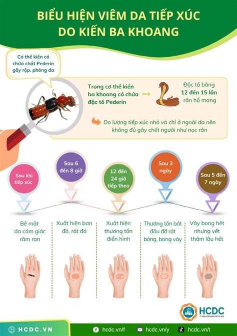 HCDC Biểu hiện viêm da tiếp xúc do kiến ba khoang Bệnh viện quận 11