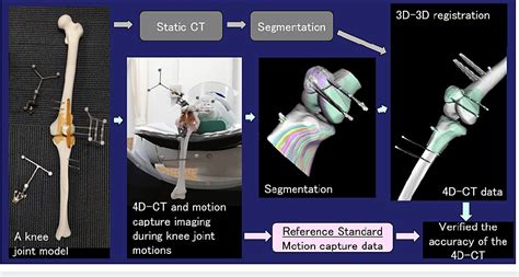 Figure 1 From Accuracy Verification Of Four Dimensional Ct Analysis Of Knee Joint Movements A