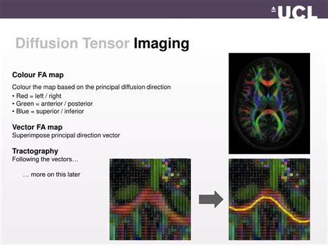 ppt diffusion tensor imaging powerpoint presentation free download