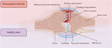 Synovial Membrane Diagram