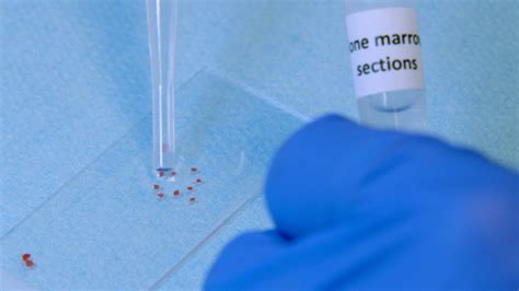 视频 Proplatelet Formation Dynamics Of Mouse Fresh Bone Marrow Explants