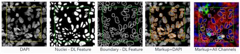 A Guide To Cell Segmentation In Multiplex Tissue Imaging With Ai