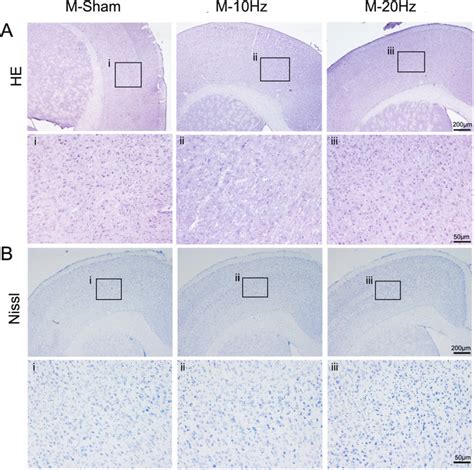 Histological Evaluation In The Primary Motor Cortex After TI Download Scientific Diagram