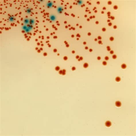 Streptococcus