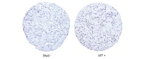 Cross Talk Between The Scf And Apc C Regulates Cell Cycle Progression Download Scientific