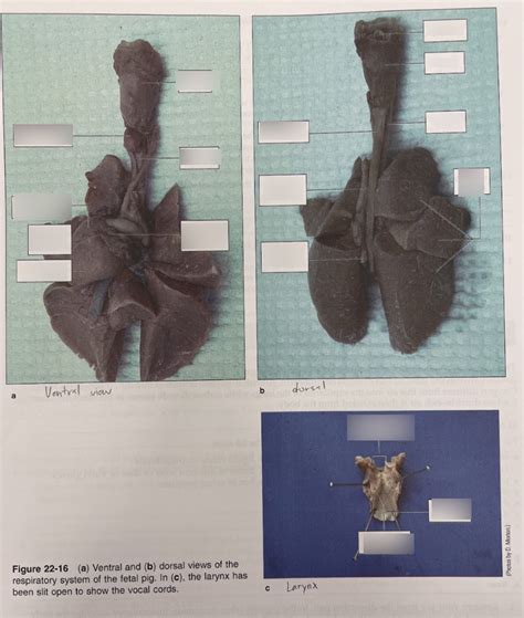 Respitory System Diagram Quizlet