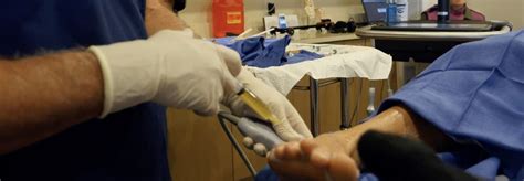 Non Surgical Ankle Tendon Tear Treatment In Tampa