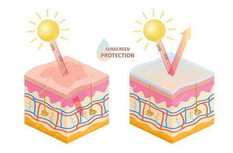 인간의 피부 자외선 보호 자외선 차단제 Sun Uva Uvb 표피 손상 방지 로션 피부 햇볕에 탐 벡터 Infographic 전후 프리미엄 벡터