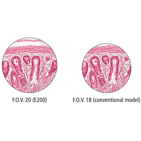 Nikon Mikroskop Eclipse E200 Led Trino Infinity E Plan 40x 1000x