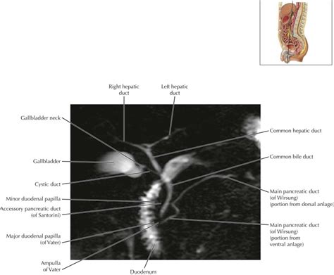 Biliary System Radiology Key