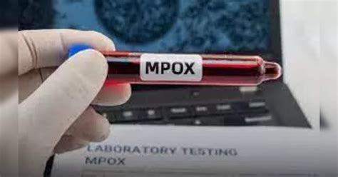 Morocco Produces Africas First Mpox Tests As The Continent Tries To Rely Less On Imports