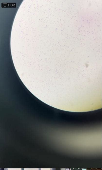 Solved Does This Look Like S Aureus Or Micrococcus Just By