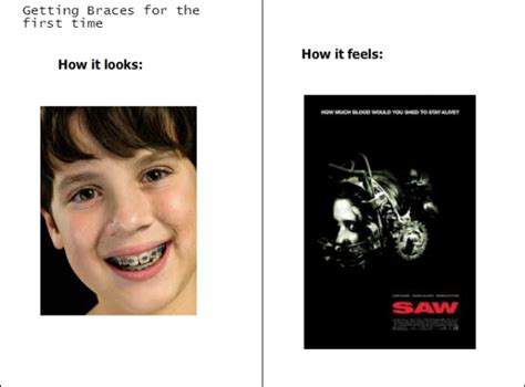 Getting Braces Meme Guy
