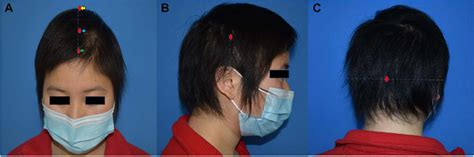 Marked Points Red Dot At Different Scalp Areas A Green Arrow Shows Download Scientific