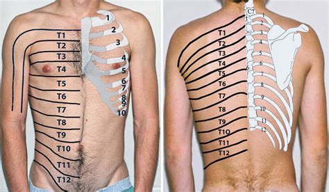 Intercostal Nerve Block
