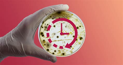 3 Day Turnaround Time For Total Viable Count Tvc And Colony Count Cc Testing Adsl