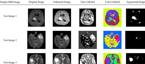 Image Segmentation Using K Means Download Scientific Diagram