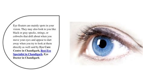 Ppt Eye Floaters Causes Symptoms And Treatment Powerpoint Presentation Id10370088