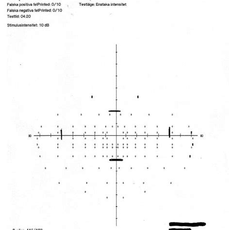 Esterman Visual Field Test Output From The Humphrey Visual Field Download Scientific Diagram