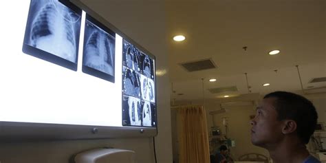 Revolutionizing Tuberculosis Detection In Vietnam Think Global Health