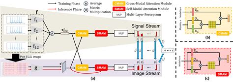 Refining Myocardial Infarction Detection A Novel Multi Modal Composite