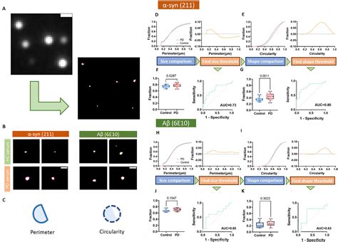 Correction To Imaging Protein Aggregates In Parkinsons Disease Serum Using Aptamer Assisted