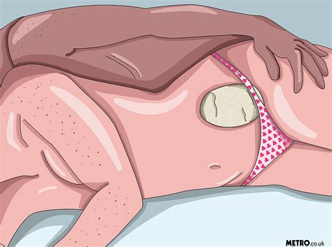 Hannah Witton Shares How To Have Sex When You Have A Stoma Metro News