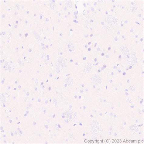 Loricrin重组抗体[epr28296 23] Loricrin抗体 Ab315807 Abcam中文官网