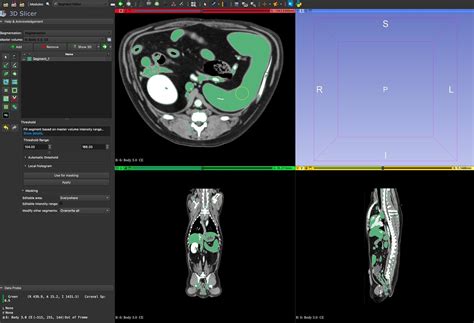 3d model not showing support 3d slicer community