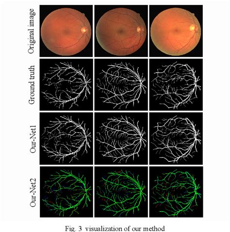 Figure 1 From A Novel Dual Supervised Convolutional Network For Retinal