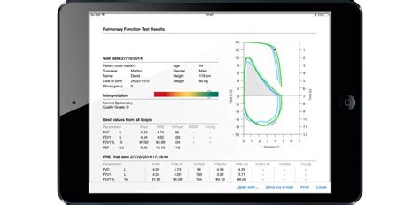 Mir Spirobank Ii Basic Spirometer With 60 Flowmir Turbines