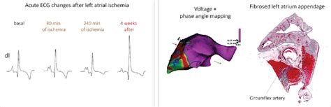 Electrical And Structural Atrial Changes Download Scientific Diagram
