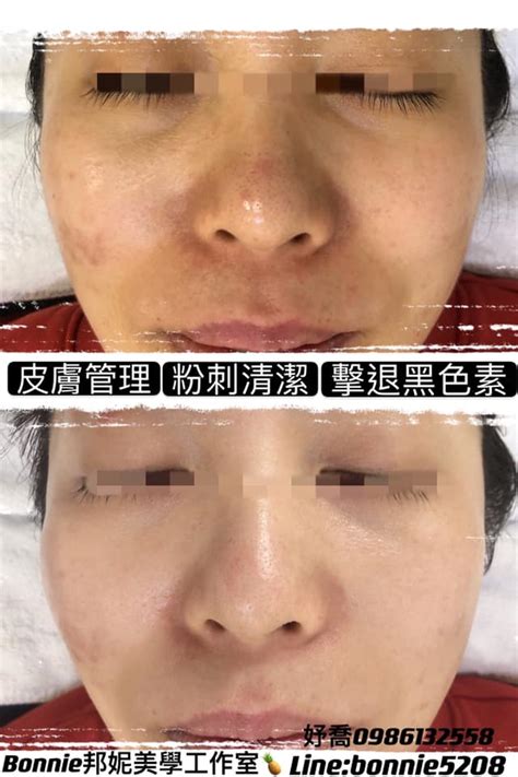 很多人好奇～ 為什麼我的皮膚管理會這麼熱門呢？ 你們想知道～ 我是怎麼在這個大環境殺出一條血路的嗎？😂（又誇飾法 其實很簡單噢！ 只要效果出來了～ 比說千言萬語還有說服力😏 皮膚管理其實包含很