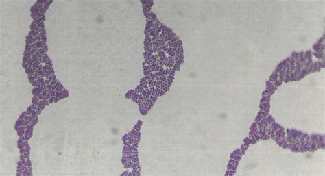 Positive Gram Stain Micrococcus Luteus Image Tim Sandle Download Scientific Diagram