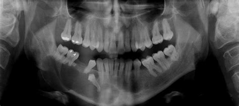 One Of The Panoramic Images Used In The Visual Grading Analysis