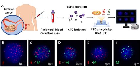 A Process Of Circulating Tumor Cells Ctcs Isolation And Detection