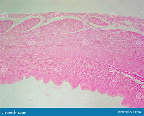 Exploring The Anatomy Distended Section Of A Bladder At 100x Stock
