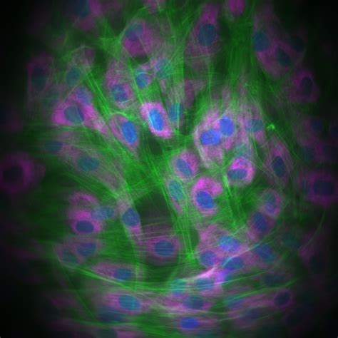 Dynamics Of The Cytoskeleton Dependent Responses Of Immune Cells
