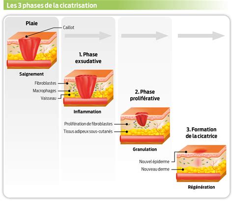 Comment Savoir Si Une Cicatrice Est Rouge Ogew
