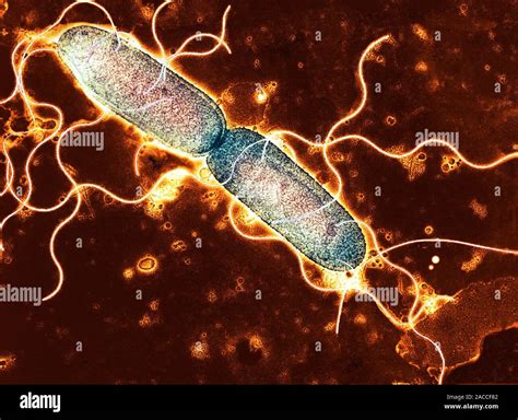 Gut Bacterium Reproducing Coloured Transmission Electron Micrograph