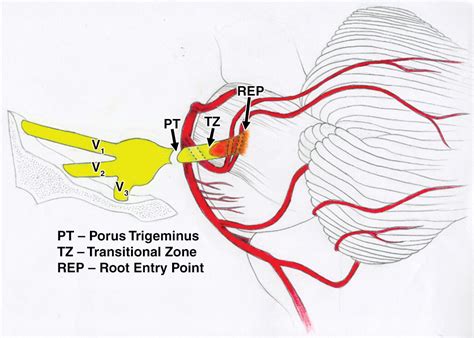 Trigeminal Nerve Brainstem