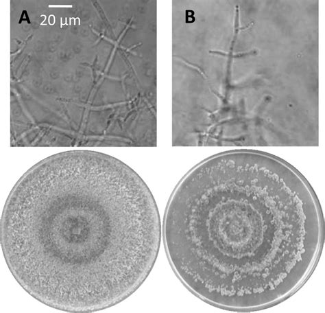 Characters Of Conidiophores And Colonies Of Trichoderma Harzianum Th1