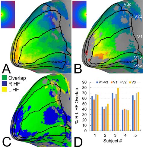 Monocular Right Eye Hemifield Eccentricity Maps And Overlap A Download Scientific Diagram