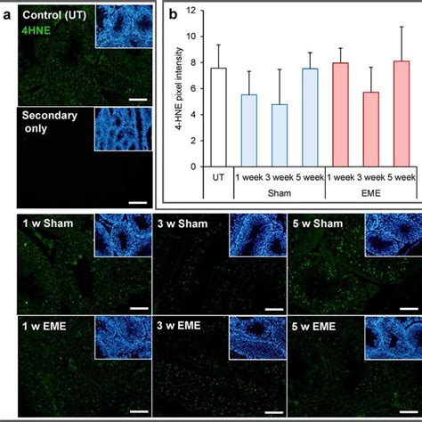 Sperm Vitality And Motility Declines In Response To Rf Eme Exposure