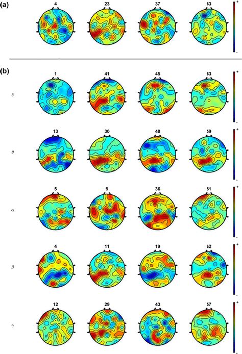 Topoplots Of Common Spatial Pattern Csp Weight Matrix Corresponding