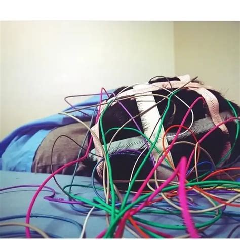 Autoimmune Encephalitis Panel Serum Test Near You In Delhi Book Test